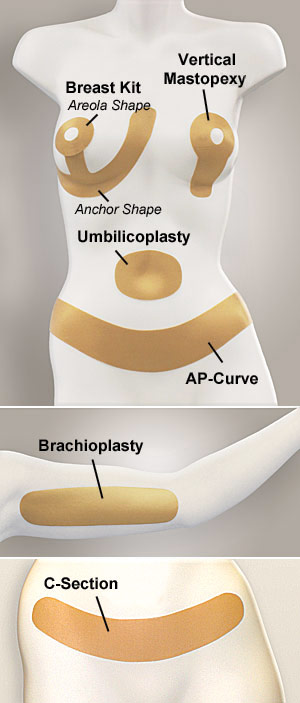Scar Management | Forley Plastic Surgery Blog